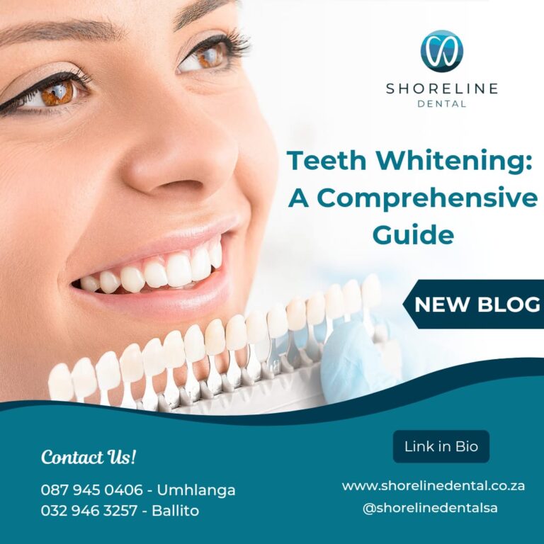 Teeth Whitening: A Comprehensive Guide - Shoreline Dental
